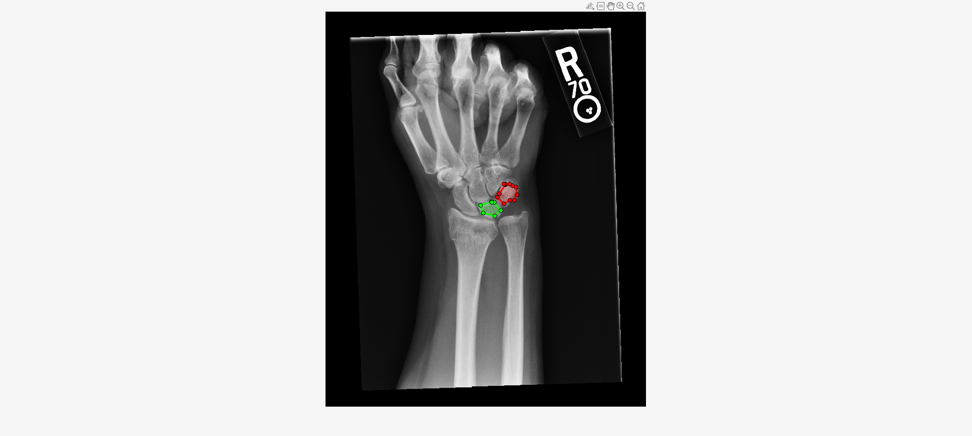 intensityFeatures - Radiomics intensity features - MATLAB